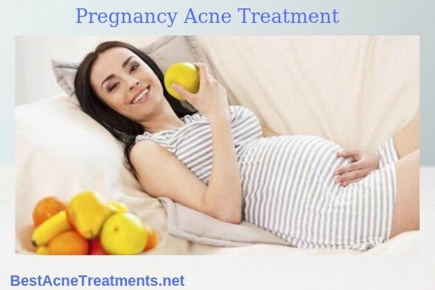Best Acne Treatment Safe for Pregnancy - Top Acne Treatments Review