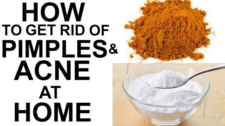 Homemade Remedies for Pimples - Top Acne Treatments Review
