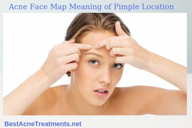 Acne Face Map: Meaning of Pimple Location - Top Acne Treatments Review