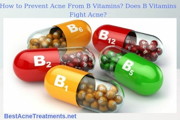 How to Prevent Acne From B Vitamins? Does B Vitamins Fight Acne? - Top ...