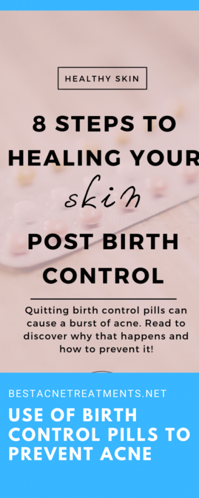 Use of Birth Control Pills to Prevent Acne - Top Acne Treatments Review