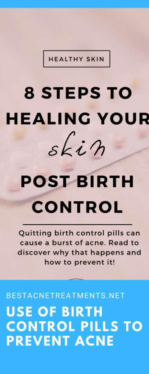 Use of Birth Control Pills to Prevent Acne - Top Acne Treatments Review